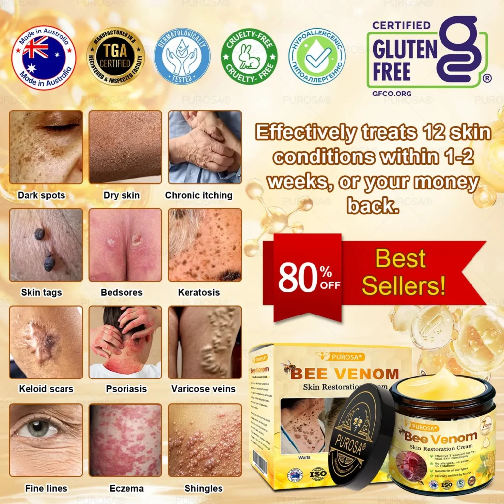 Bee Venom – Maxharbs